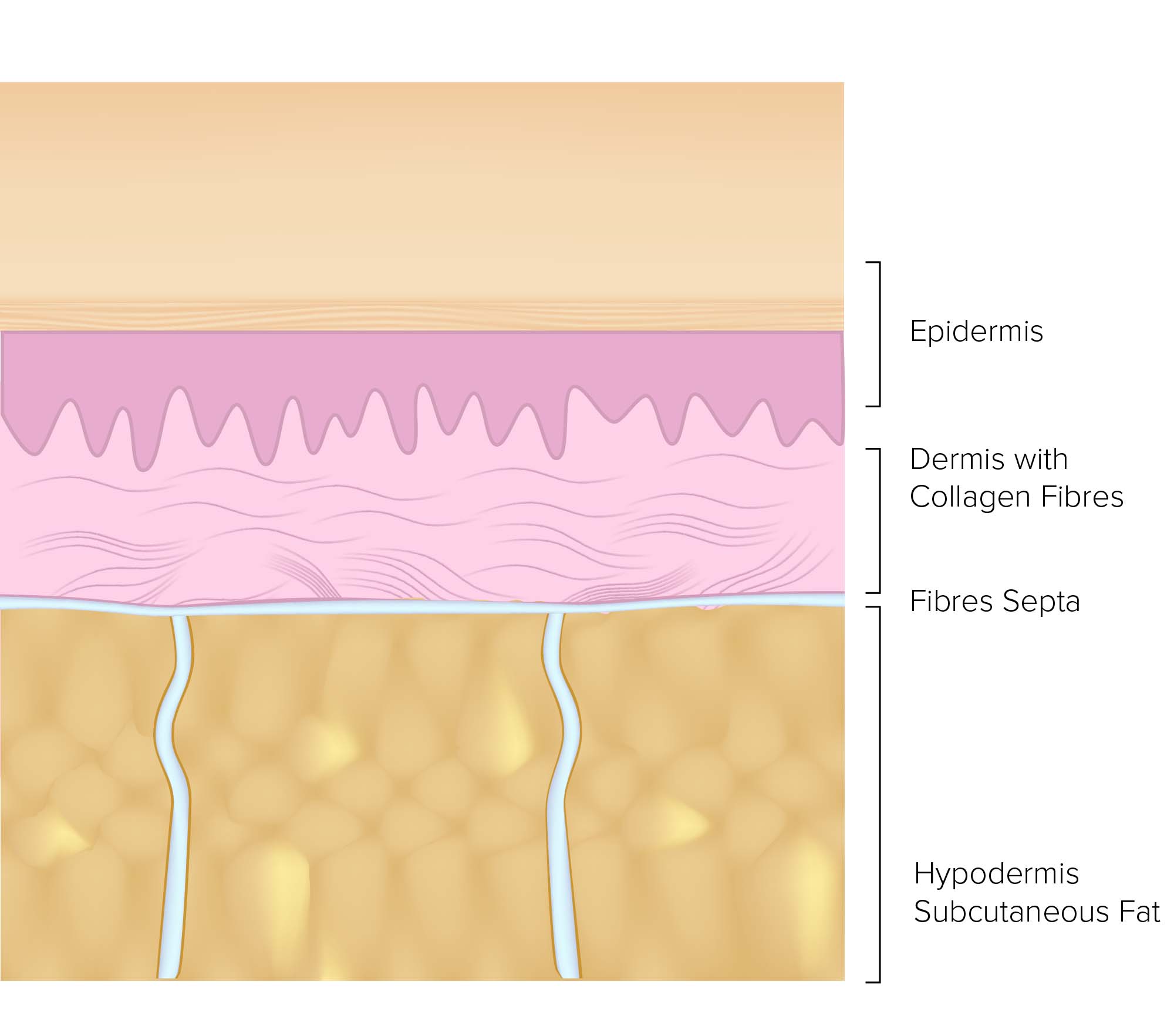 Cellulite Treatment Machines - CliniMed Aesthetics
