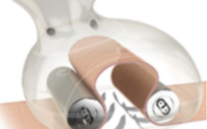 POWERSHAPE 2 - Cellulite Reduction Machine - CliniMed Aesthetics