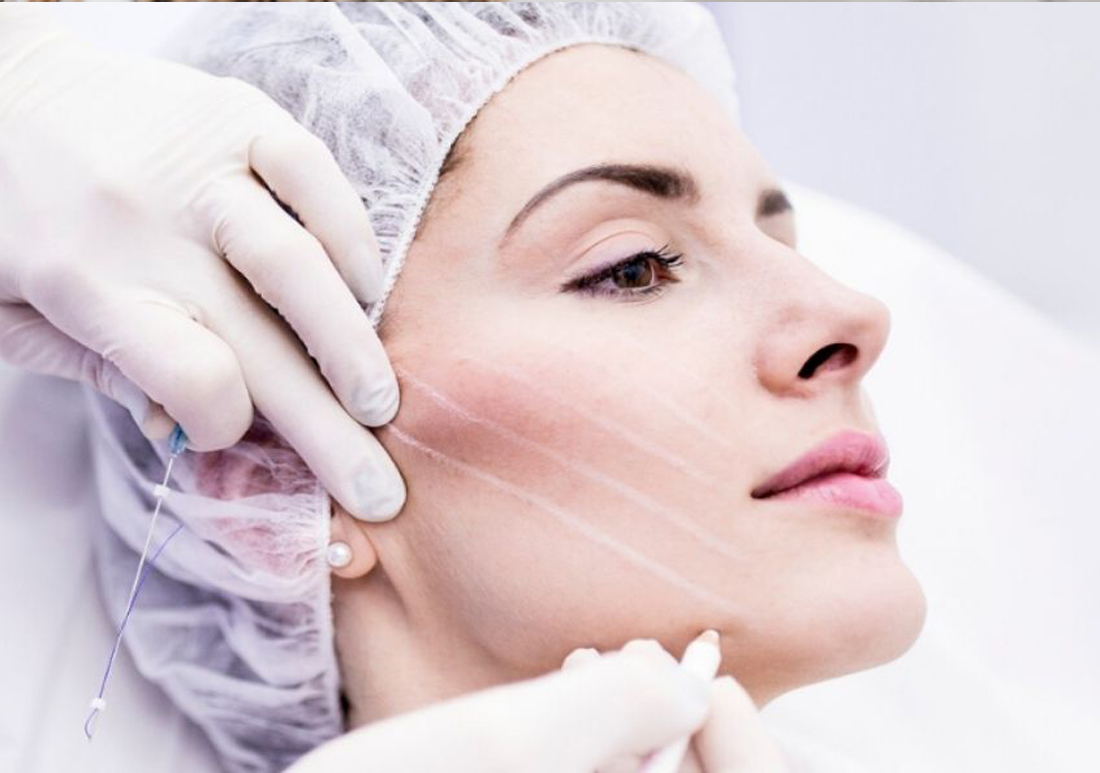 Mono Threads: Understanding The Basics Of This Innovative Procedure